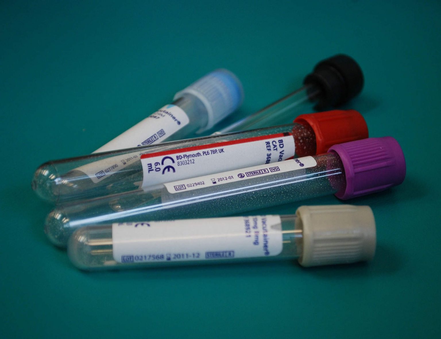 ¿Hay tratamiento para curar el Síndrome Schaaf-Yang?