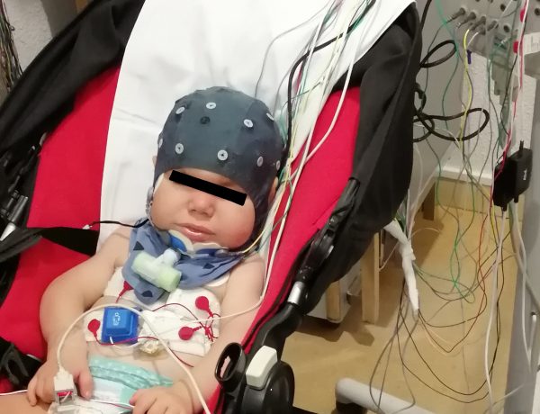 ¿Hay tratamiento para curar el Síndrome Schaaf-Yang?